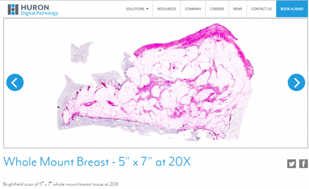 breast preview - Huron Digital Pathology