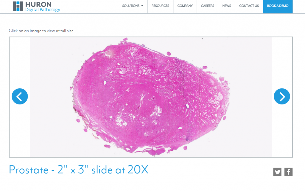 gallery tyhumb - Huron Digital Pathology