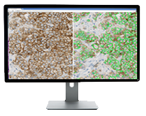 TissueScope LE120 - Huron Technologies