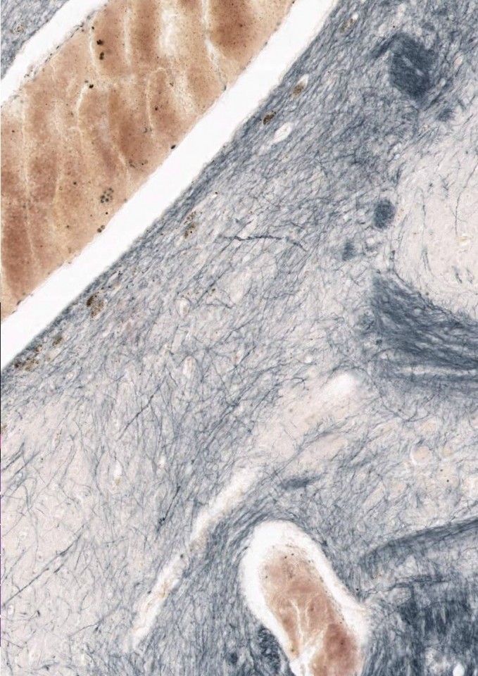 zoomwdetail - Huron Digital Pathology