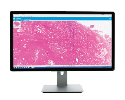 him monitor transparent - Huron Digital Pathology