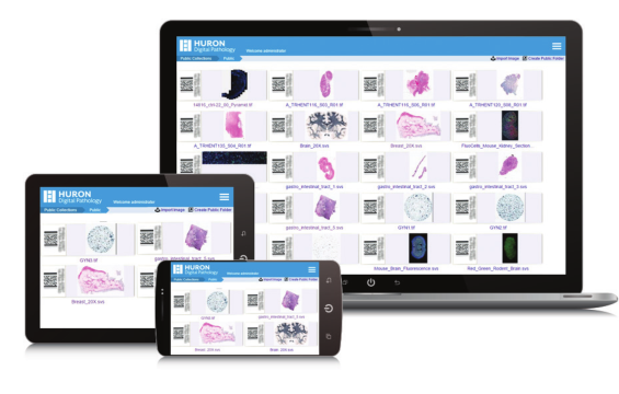 him2 - Huron Digital Pathology