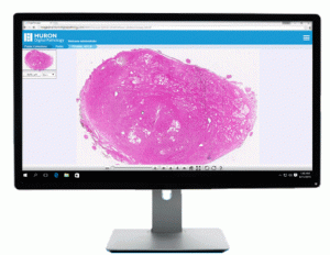 objective - Huron Digital Pathology