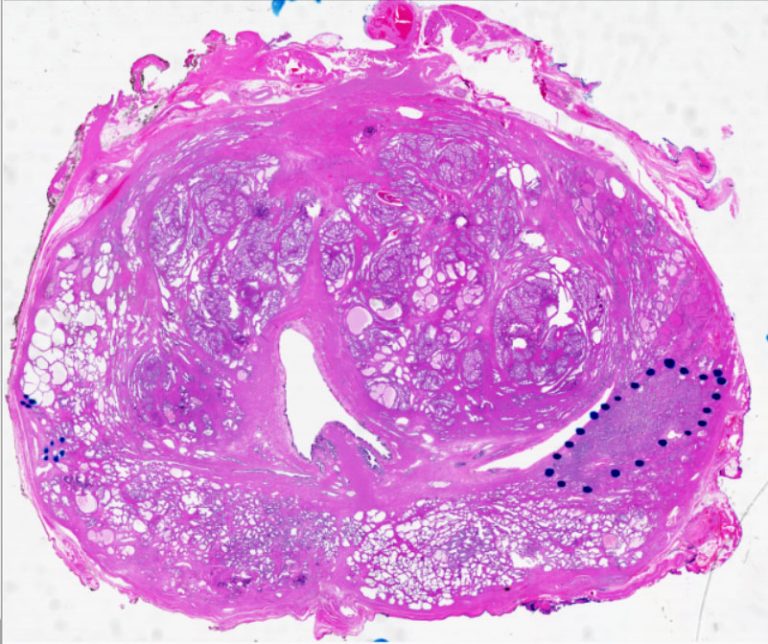 prostate-2 - Huron Digital Pathology