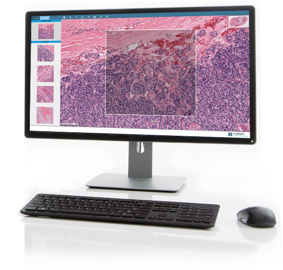 yottixel-on-screen - Huron Digital Pathology